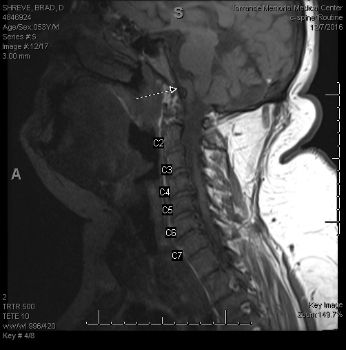 MRI2 – Insights From A Bipolar Bear